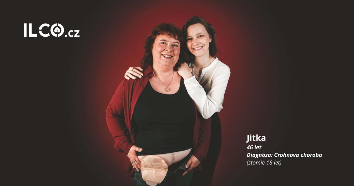 Komplikace po operaci hemeroidů byly důvodem k vyvedení stomie - České ILCO, z.s.